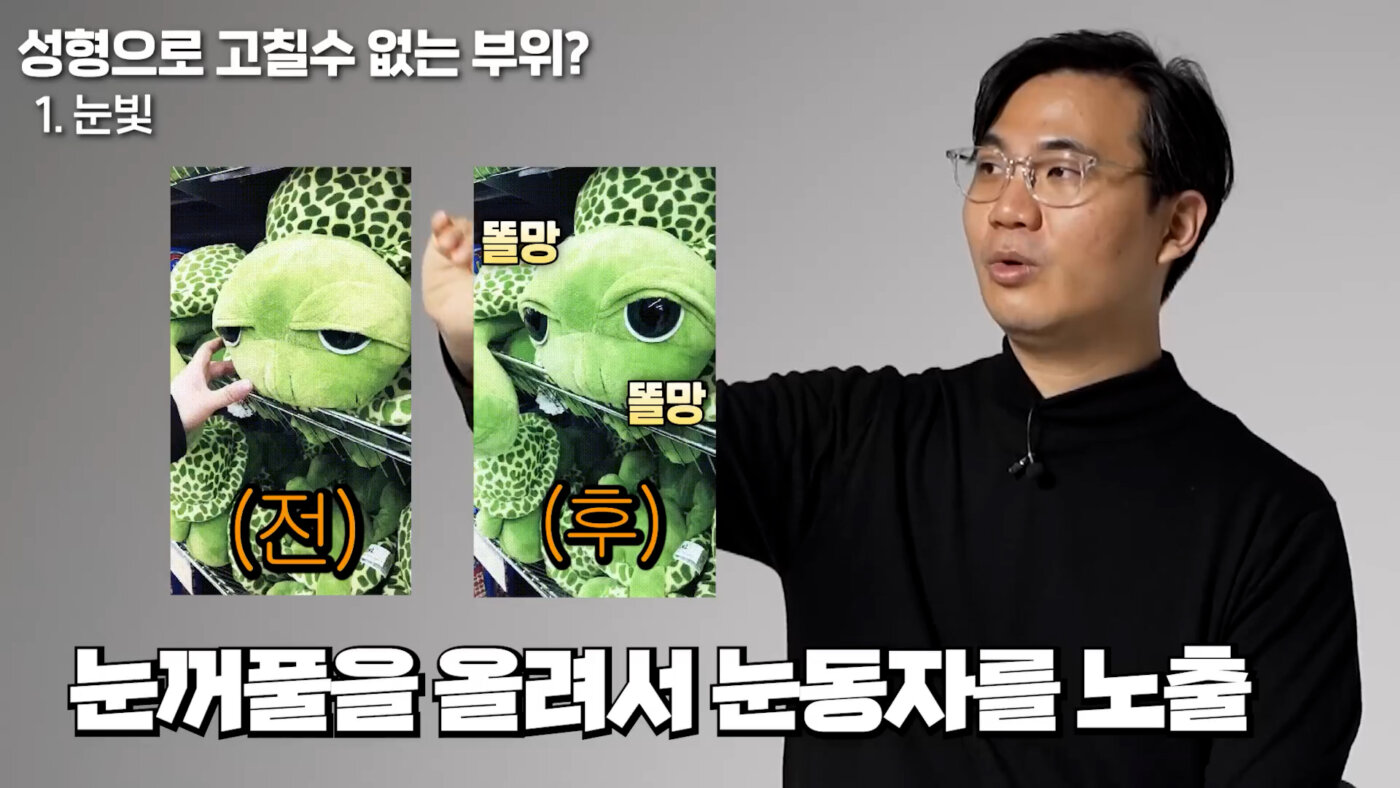 이제 눈동자 크기와 컬러를 바꿀 수 있는 시대?! 눈동자 수술에 대해서 | 얼루어 코리아 (Allure Korea)