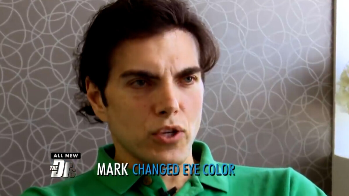 이제 눈동자 크기와 컬러를 바꿀 수 있는 시대?! 눈동자 수술에 대해서 | 얼루어 코리아 (Allure Korea)